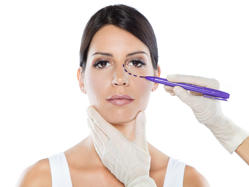 Eyelid Aesthetics - Blepharoplasty - İzmir Estetik ve Plastik Cerrahi Eyelid Aesthetics - Blepharoplasty - İzmir Estetik ve Plastik Cerrahi
